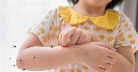 황금연휴 기간 동남아 여행 땐 ‘모기매개감염병 주의 [부모 백과사전]