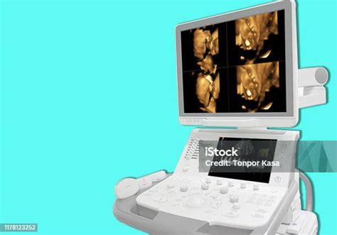 병원 진단실에서 선형 프로브가있는 의료 초음파 기계 현대 의료 장비 예방 의학 및 의료 개념 건강관리와 의술에 대한 스톡 사진