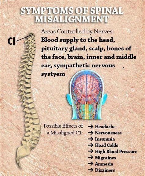 Symptoms Of Spinal Misalignment Upper Cervical Chiropractic Chiropractic Chiropractic Treatment