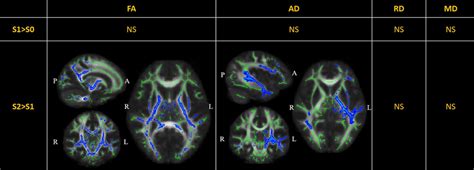 Perioperative Changes In Diffusion Tensor Imaging DTI Metrics Across Download Scientific