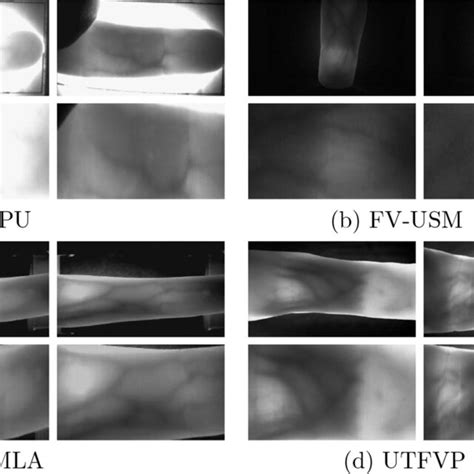 Finger Vein Images And Their Corresponding Roi Images Download