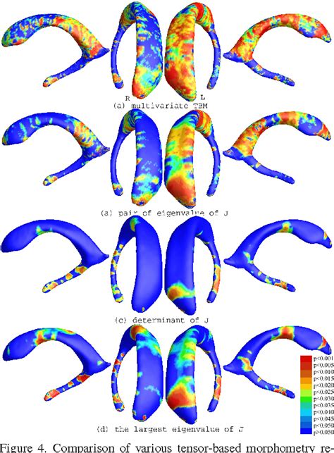 Figure 4 From Shape Analysis With Multivariate Tensor Based Morphometry