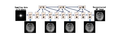 深度交替方向乘子法admm Net用于压缩感知mri研究（matlab代码实现） Admm Net Csdn博客
