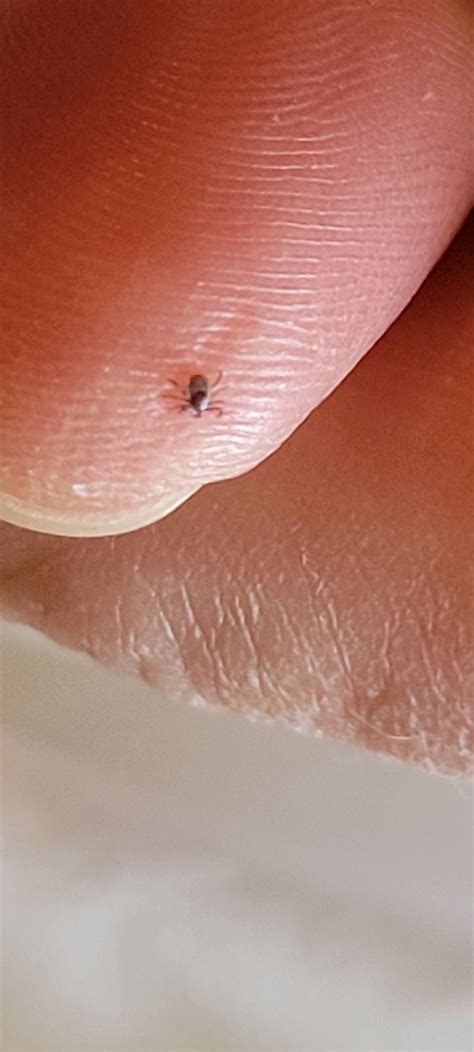 Tick R Whatbugisthis