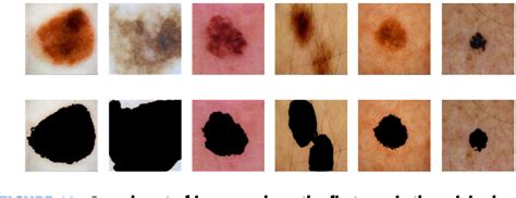 Figure 1 From Assessing Bias In Skin Lesion Classifiers With Contemporary Deep Learning And Post