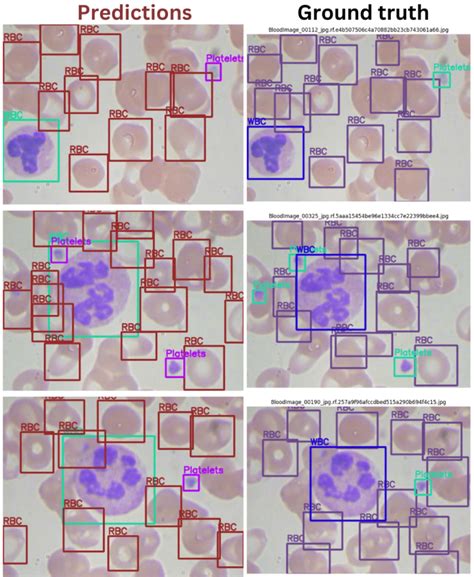 Train Pytorch Retinanet On Custom Dataset Debuggercafe