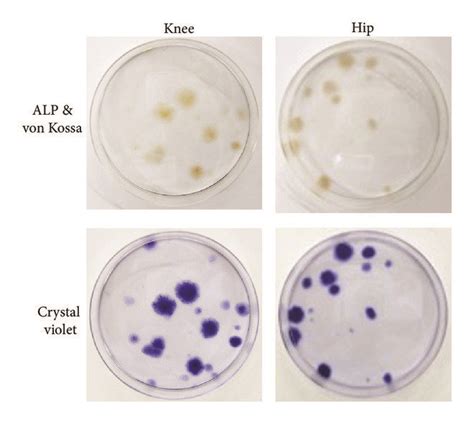 Osteogenic Potential Of Each Type Of Mscs A Colonies Stained