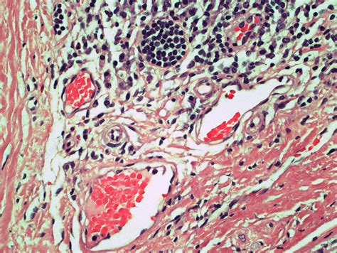 Reactive Lymph Node Germinal Centers Stock Image C012 1400 Science Photo Library