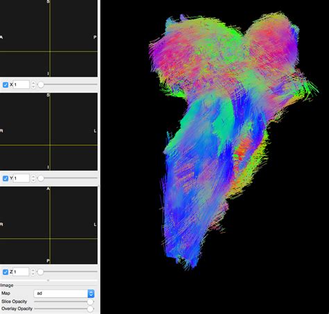 Dipy Streamlines Not Aligning With Image Space Dipy Neurostars
