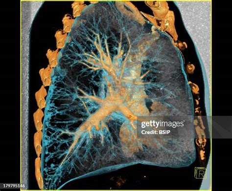3d Ct Scan Photos And Premium High Res Pictures Getty Images