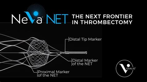 Vesalio Neva™ Net Neuro Thrombectomy Device 3d Animation Youtube