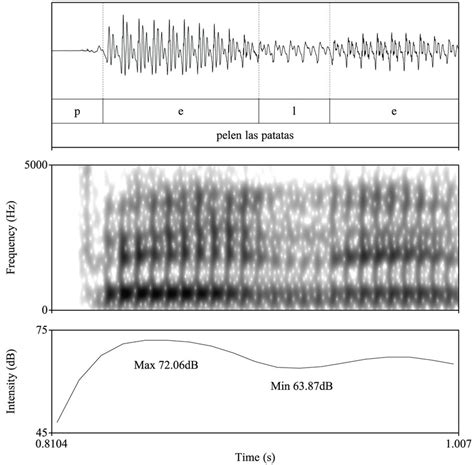 Segmentation Of L From The Test Word Pelen As Produced By Spm5