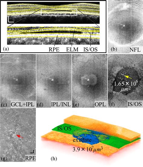 User Guided Segmentation For Volumetric Retinal Optical Coherence Tomography Images