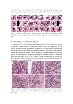 A Novel Dataset And A Deep Learning Method For Mitosis Nuclei Segmentation And Classification