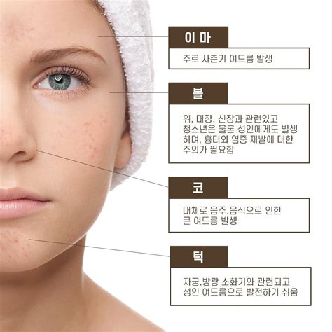 턱 여드름 원인 알고나면 관리하기 쉬워져요 네이버 포스트