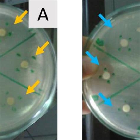 Agar Diffusion Assay Containing E Faecalis A And P Gingivalis B Download Scientific