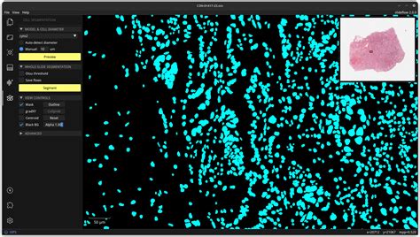 Cell Segmentation — Slideflow 220 Documentation
