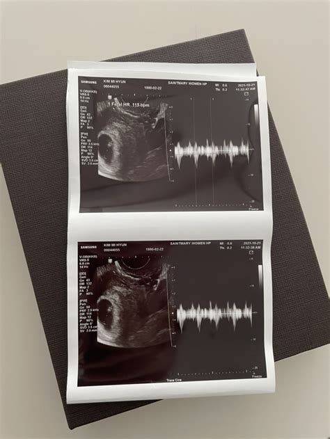 임신기록 다낭성난소임신준비배란주사임신확인임신6주차 네이버 블로그