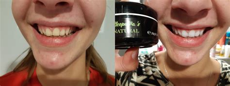 Cleopatras Natural Natural Teeth Whitening