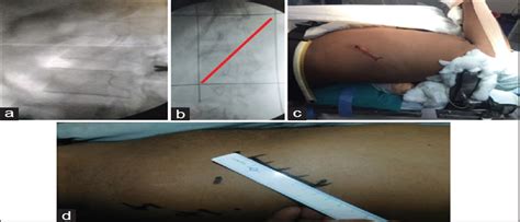Journal Of Spinal Surgery