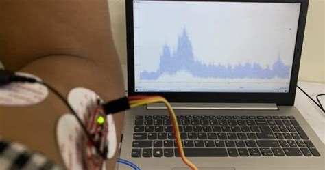 Electromyography With MyoWare Muscle Sensor Arduino