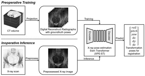 A Robust Method For Real Time Intraoperative 2d And Preoperative 3d X Ray Image Registration