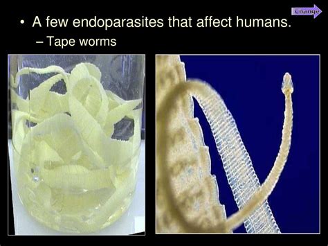 Infectious Diseases Unit Ppt Download