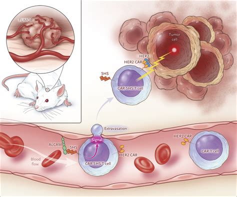 Acute Exacerbation Of Copd Care Plan