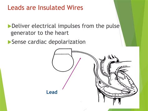 Pacemaker Basic And Timing Cycle Pptx Heart And Cardiovascular Diseases Diseases And Conditions