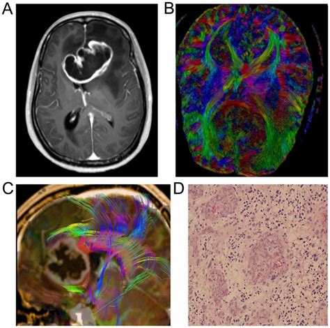 mhj 1212 introduction diffusion tensor imaging dti is a fairly new