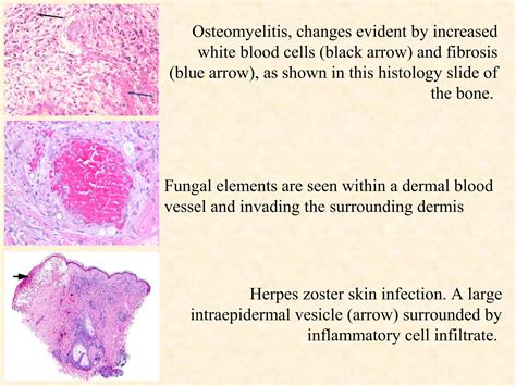 Tissue Processing In Histopathology Ppt