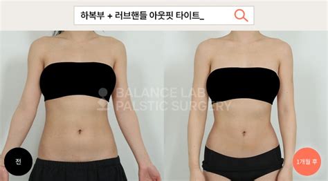 밸런스랩 성형외과