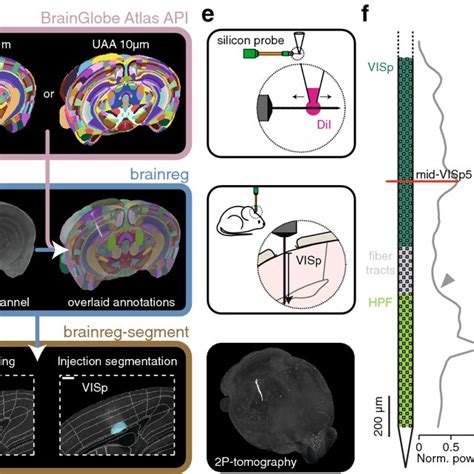 Overview Of The Brainreg Brainreg Segment Workflow And Validation Of Download Scientific