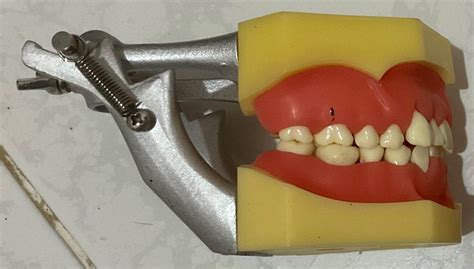 Perio Jaw Model Health And Nutrition Medical Supplies And Tools On Carousell