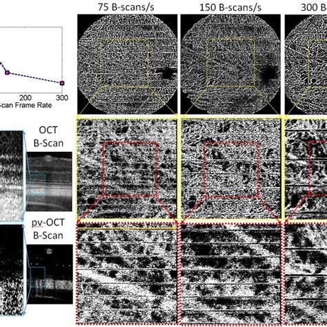 Visualization Of The Choroidal Layer With Pv Oct In Vivo In The Nude
