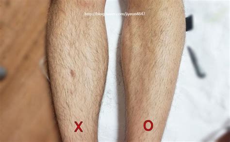 꿀팁 깔끔한 남자 반바지 입기전 필수템 😲 인트림 다리털 숱 제거👍 밋밋한 제모가 아님 아예