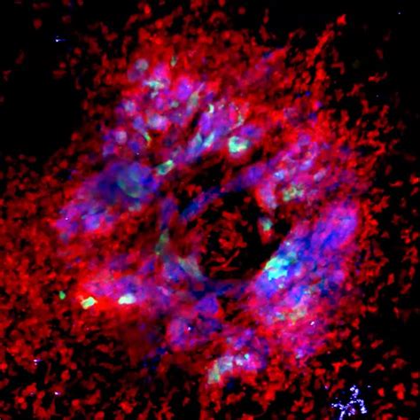 Genentech على Linkedin Cancer Immune Phenotypes