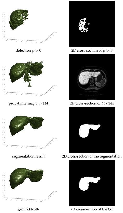 Fast D Liver Segmentation Using A Trained Deep Chan Vese Model