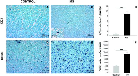 Diffuse Inflammation In The Normal Appearing White Matter Nawm Of Download Scientific Diagram