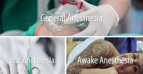 Types Of Anesthesia