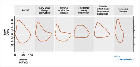 pulmonary function tests artofit