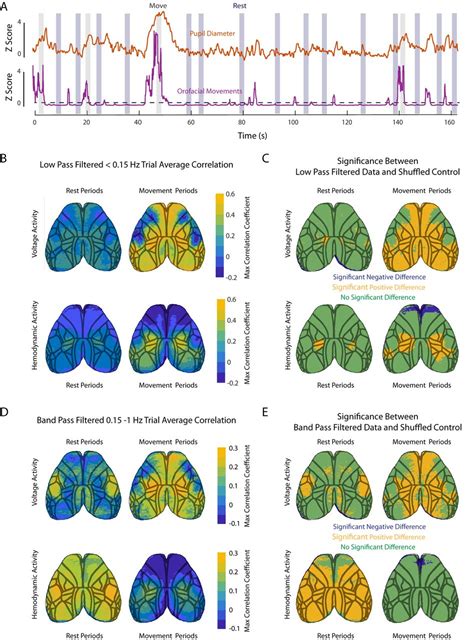 Cortical Networks Relating To Arousal Are Differentially Coupled To