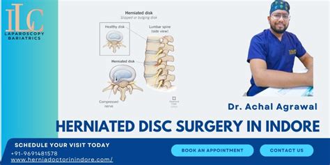 Herniated Disc Surgery In Indore Expert Spine Surgeon