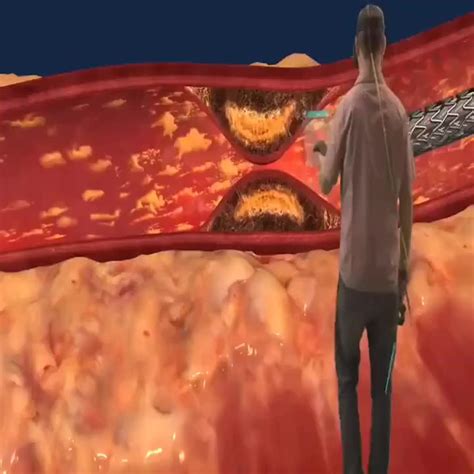 aquib ali on linkedin virtualreality iot vr augmentedreality health tech innovation