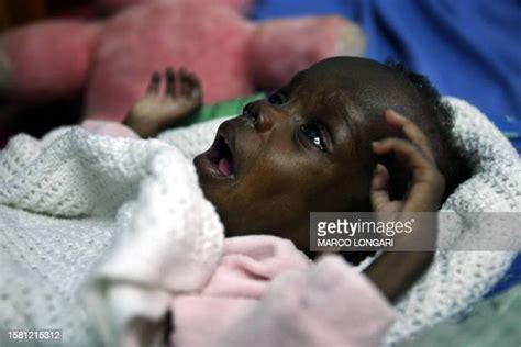 150 Mildmay Hospital Photos And High Res Pictures Getty Images