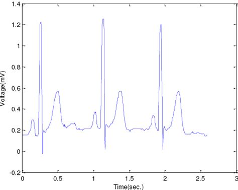 Figure 2 From Abnormality Detection In Indian Ecg Using Correlation Techniques Semantic Scholar