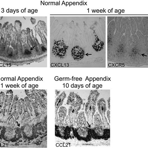 Ccl20 Ish And Ccr6 Immunohistochemistry Of Rabbit Appendix A