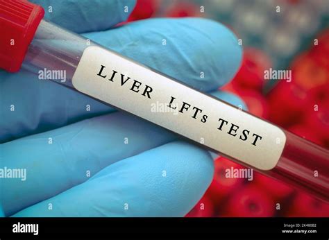 Liver Function Test Conceptual Image Stock Photo Alamy