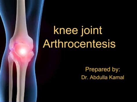 Arthrocentesis Ppt