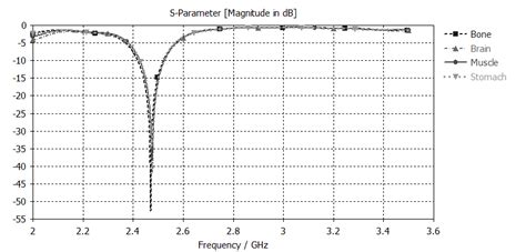 S11 Parameter Of The Antenna Using Different Human Tissue Download Scientific Diagram